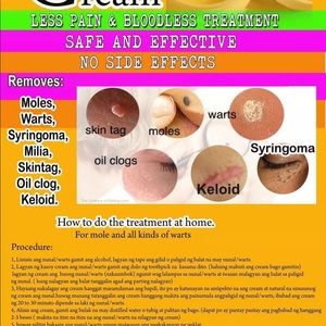 Syringoma | Skincare | Syringoma Cream Remove Syringoma 0 Effective ...